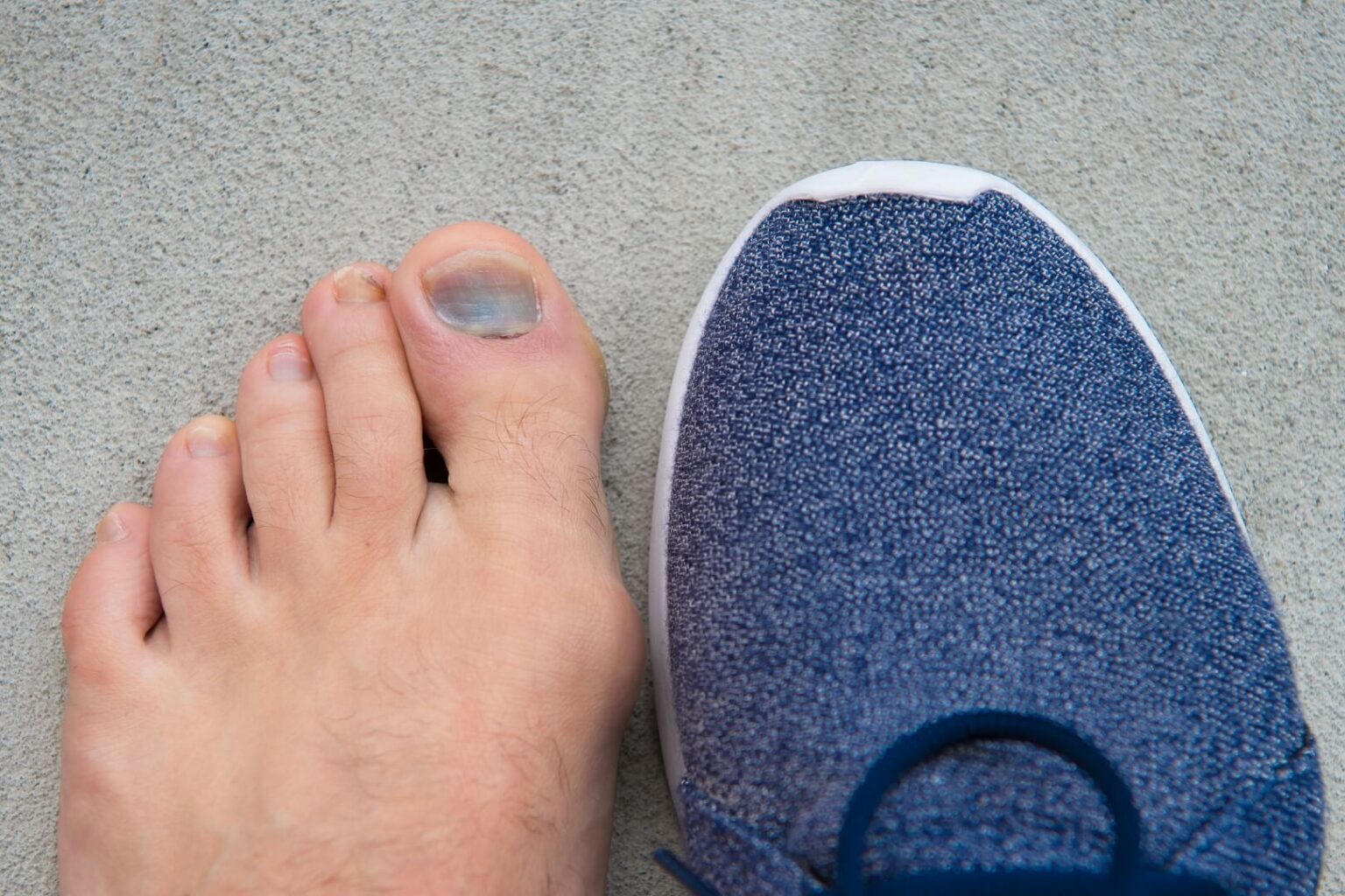 În cât timp se reface o unghie care a căzut? • Seki Edge Romania